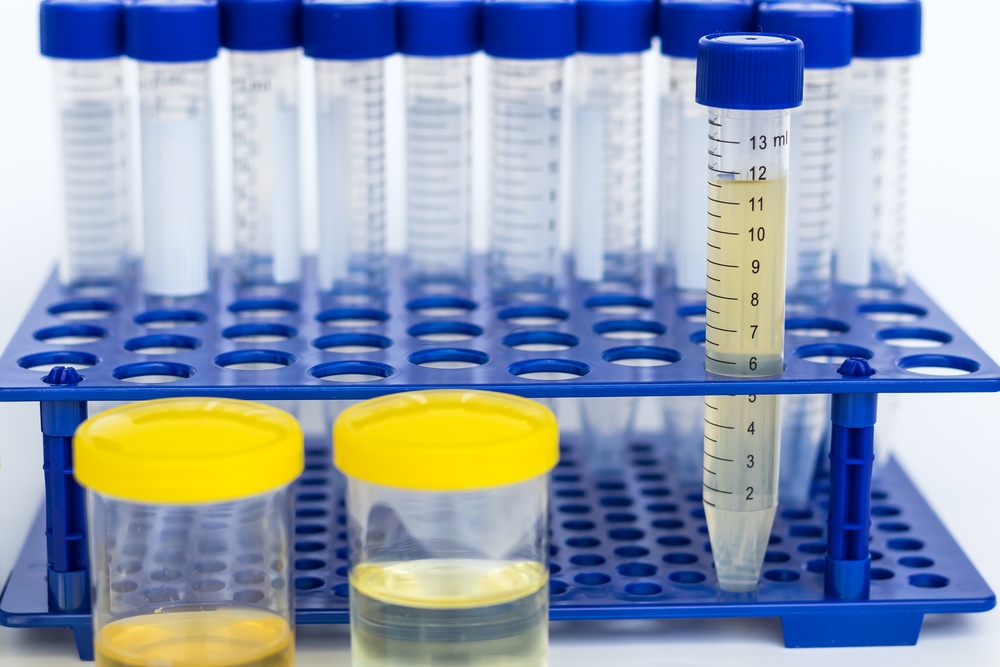 What Does ‘QNS’ Mean, and How Can it be Avoided?