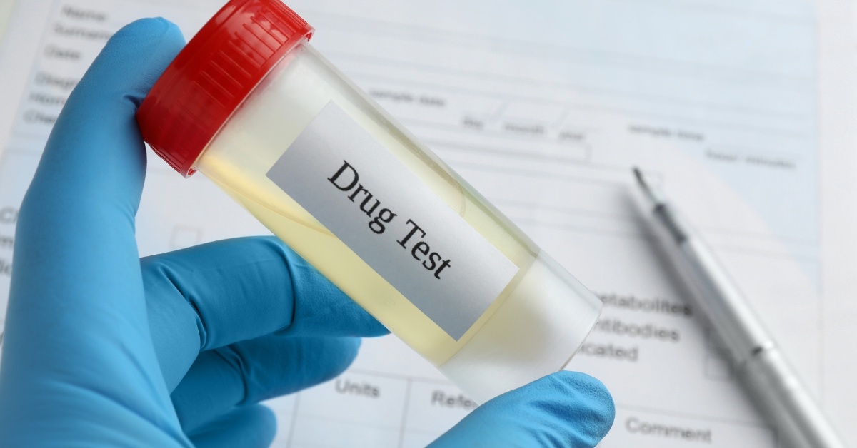 What You Need to Know About Pre-Employment Drug Testing